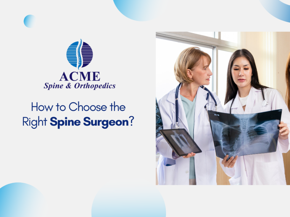 How to Choose the Right Spine Surgeon - Acme