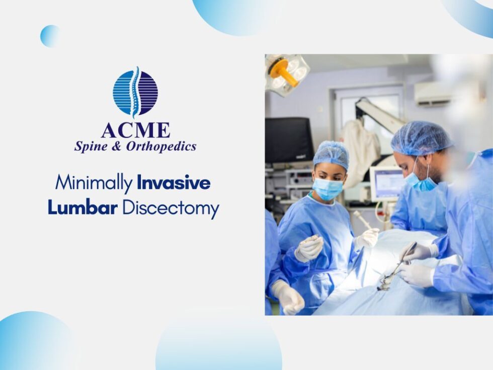 Minimally Invasive Lumbar Discectomy - Acme Spine and Orthopedics